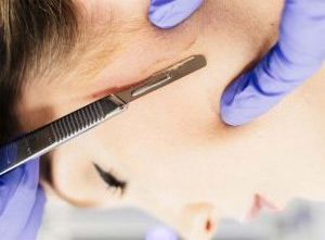 The Signature Dermaplane Facial at Skin by Design, Scottsdale AZ